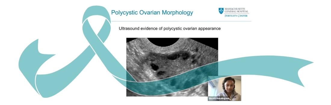 PCOS and Fertility - AllPaths Family Building